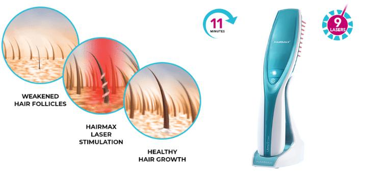 10 Rawatan Rambut Gugur di Malaysia - Toppik Malaysia